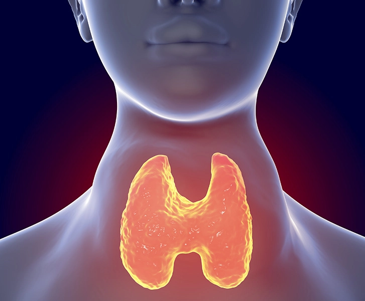 Le goitre thyroïdien - Chirurgie Thyroïde Paris